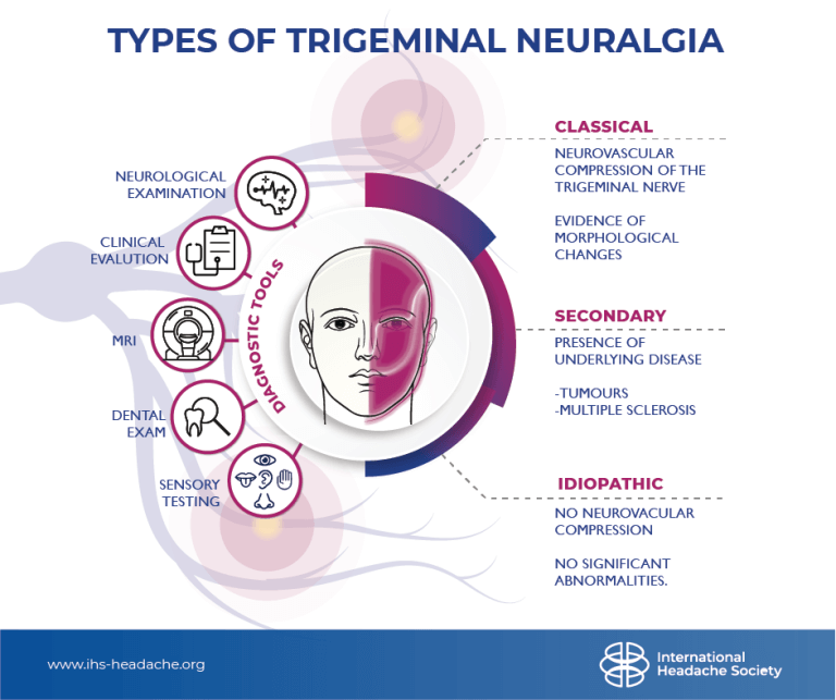 Trigeminal Neuralgia Awareness Day - International Headache Society